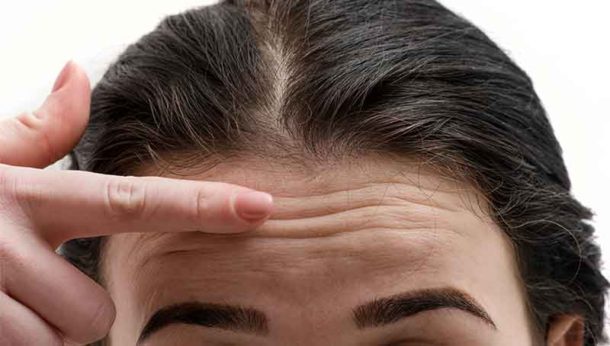 How to Get Rid of Forehead Wrinkles - Forehead Lines